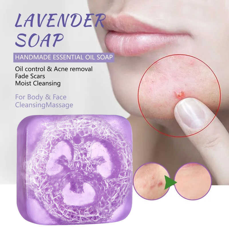 Body Bar Face Acne Remover Fade Scar Lavender Soap | Shopee Philippines