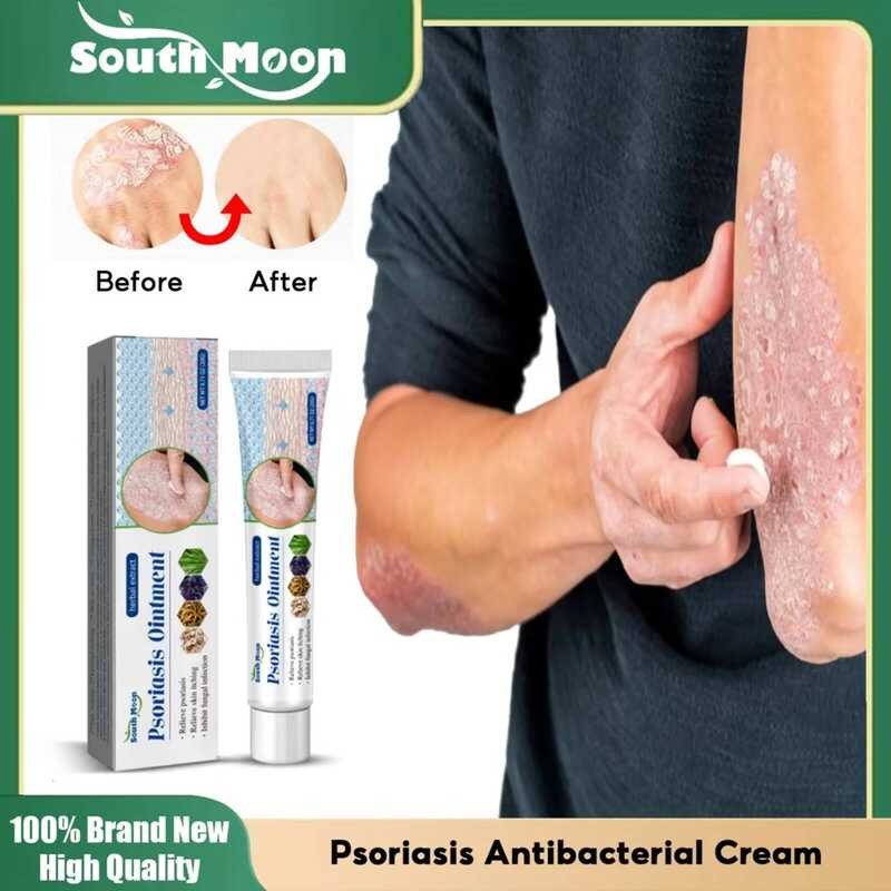 Psoriasis Antibacterial Cream Treatment Hand Tinea Relieve Urticaria ...