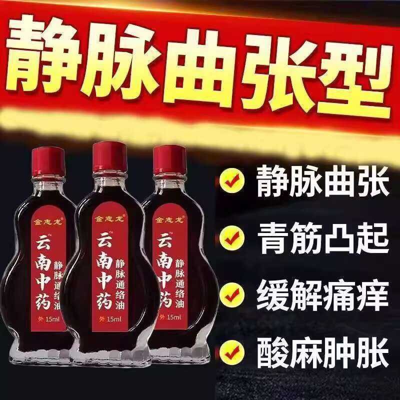 Buy 2 Get 1 Free Varicose Vein Relief Oil Earthworm Leg Blue Veins ...