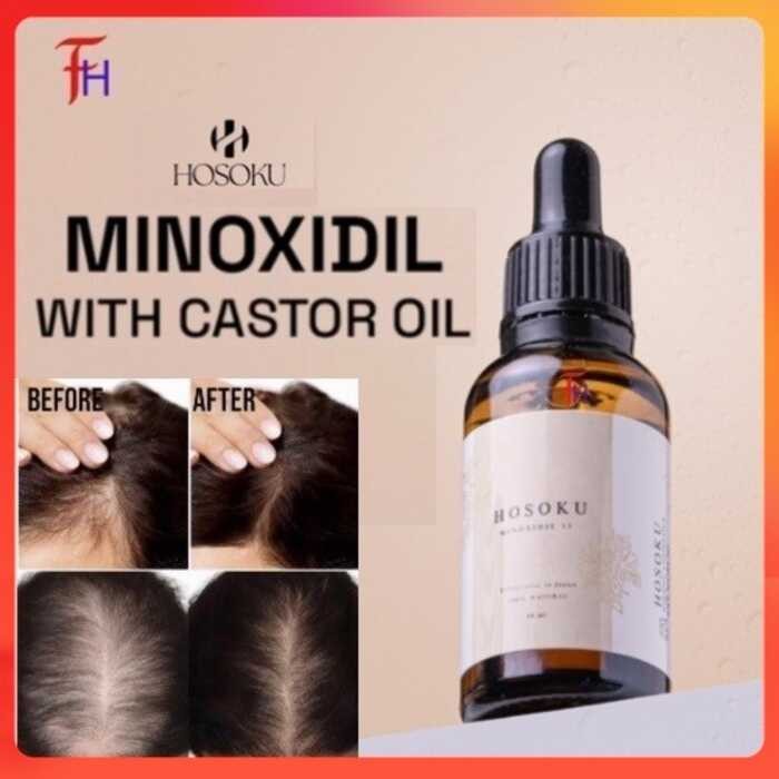 Hosoku Minoxidil 15% Hair Growth With Collagen And Castor Oil, Serum ...