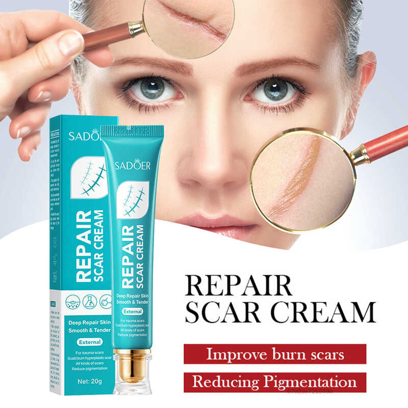 For Men And Women Practical Trauma Relief Cream For Burn Repair And ...