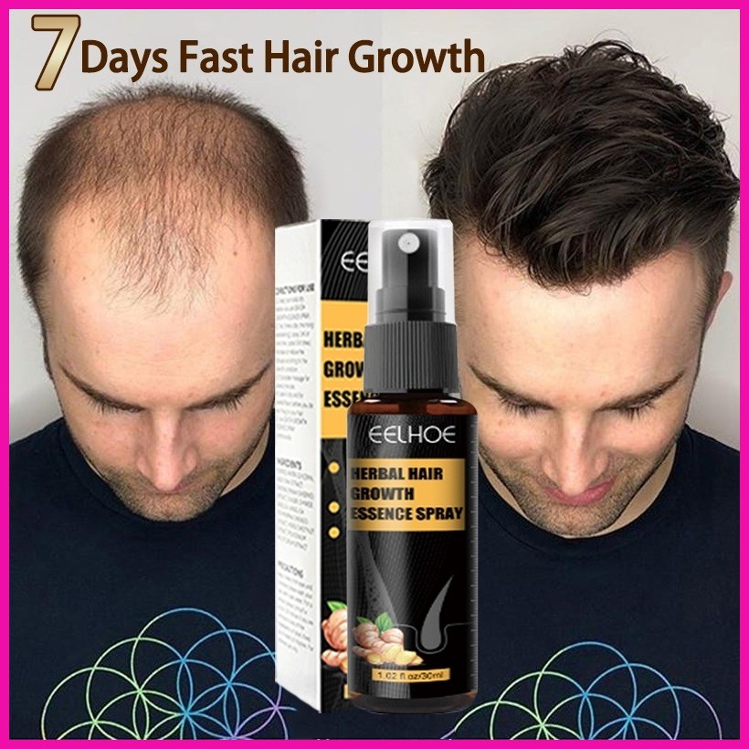 Fast Hair Growth Hair For Men Original Minoxidil Regrow Ginger Hair ...