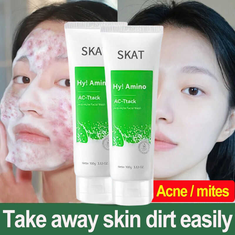 【Buy 1 TAKE 1】Skat Hy!Amino Ac-Ttack Salicylic Acid Amino Facial ...