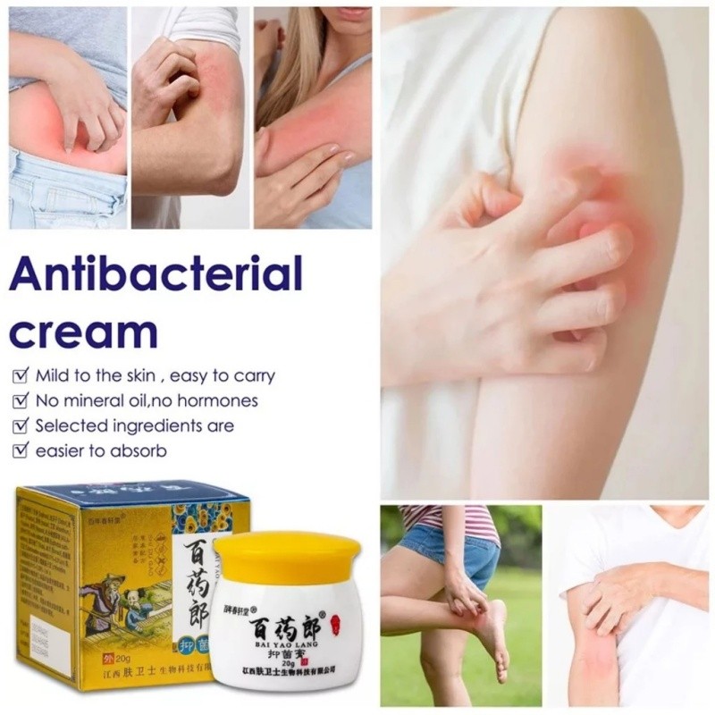 Baiyaolang skin cream 20g Antibacterial, Eczema & Psoriasis Relief ...