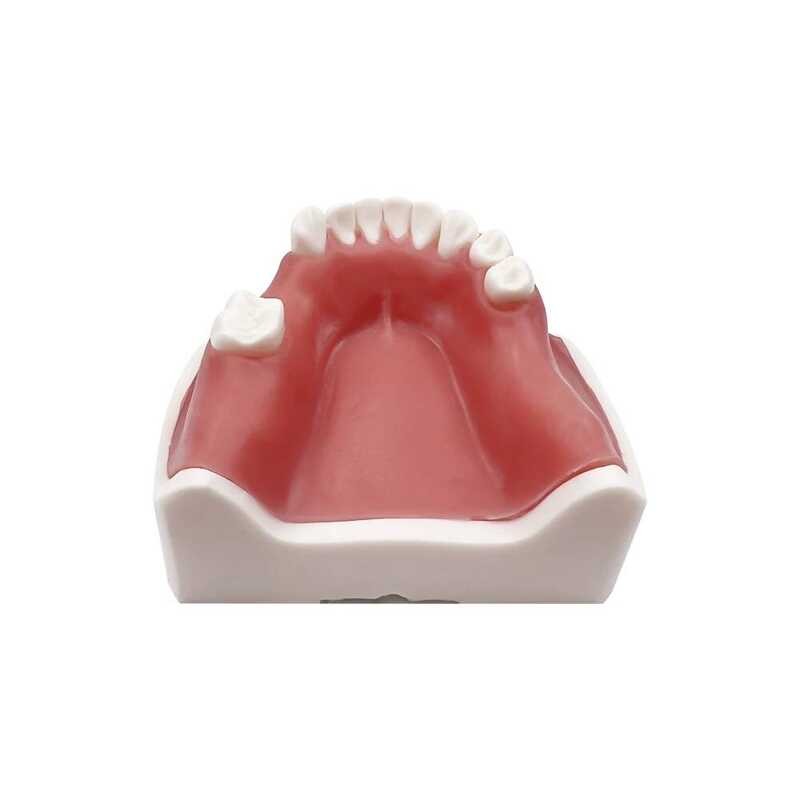 Teeth Dental Jaw Implant Practice Demo Typodont Soft Gum Study Teaching ...