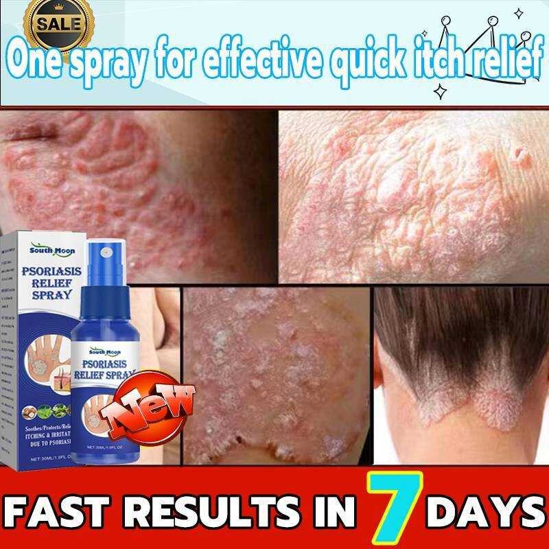 【Authentic South Moon】Psoriasis Antibacterial Eczema Anti Itch Spray ...