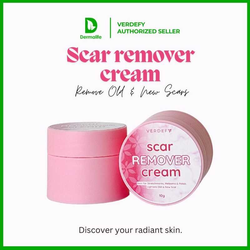 ⚡ FLASH Sale⚡ 10G Scarcream & Stretchmarks Peklat Acne Treatment Old ...