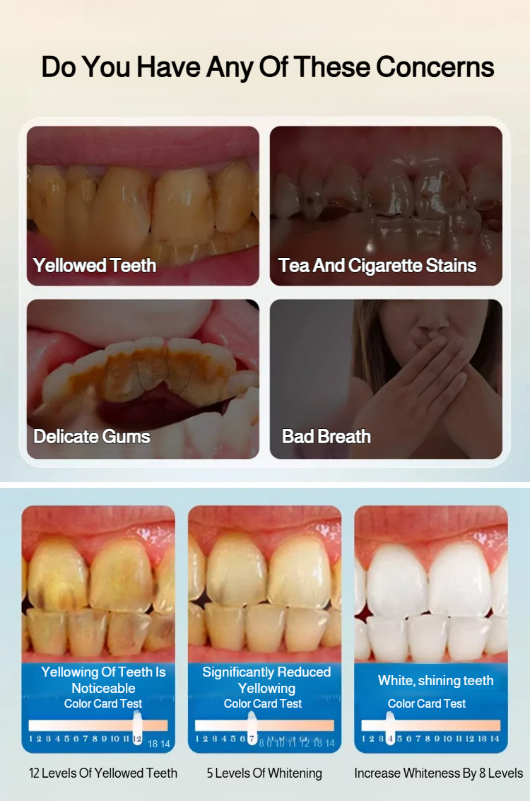 【Dual-Effect Whitening】Probiotic Lysozyme Whitening Toothpaste/Pushon ...