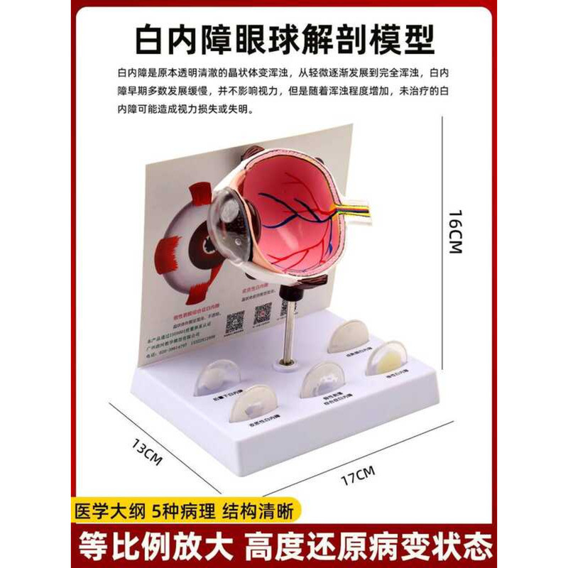 Human Body Teaching Eyeball Anatomy Structure Model Detachable Children ...