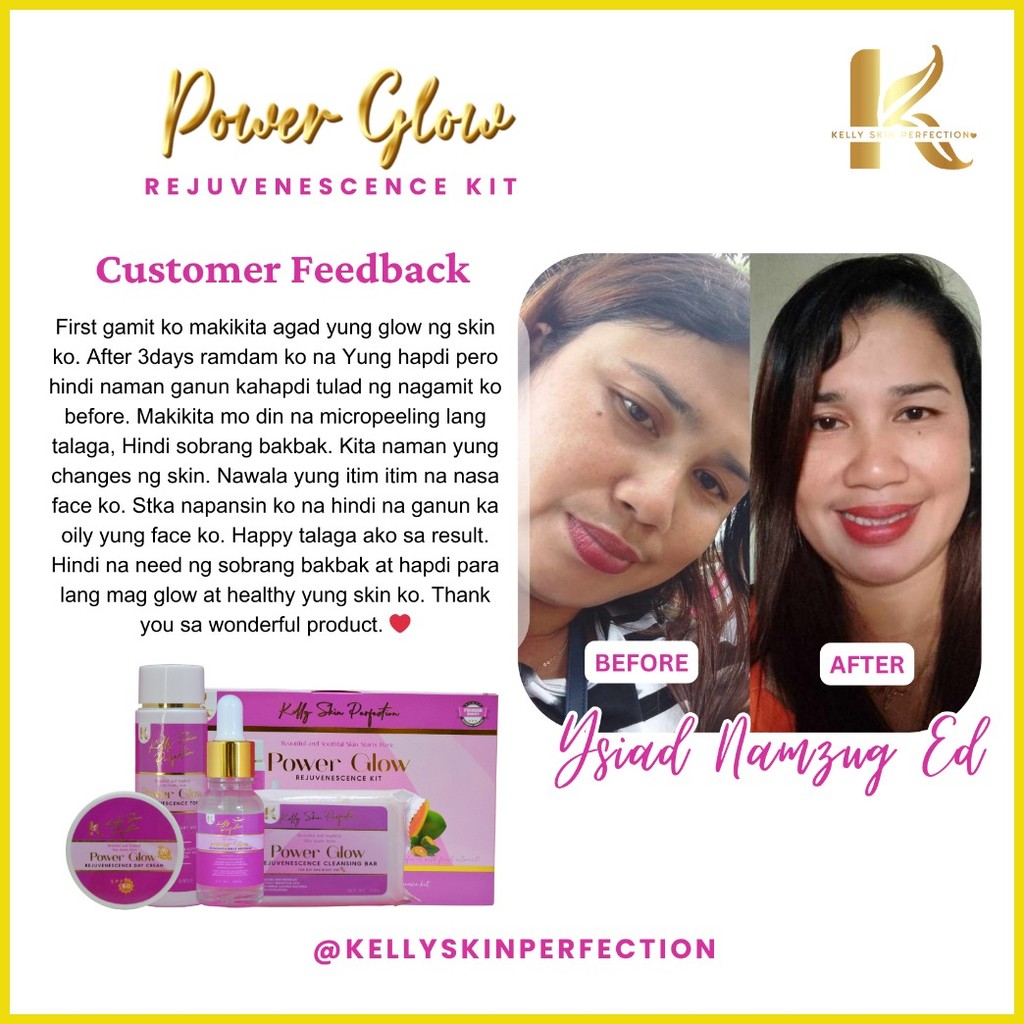KELLY SKIN PERFECTION POWER GLOW REJUVENESCENSE KIT MICROPEELING ...