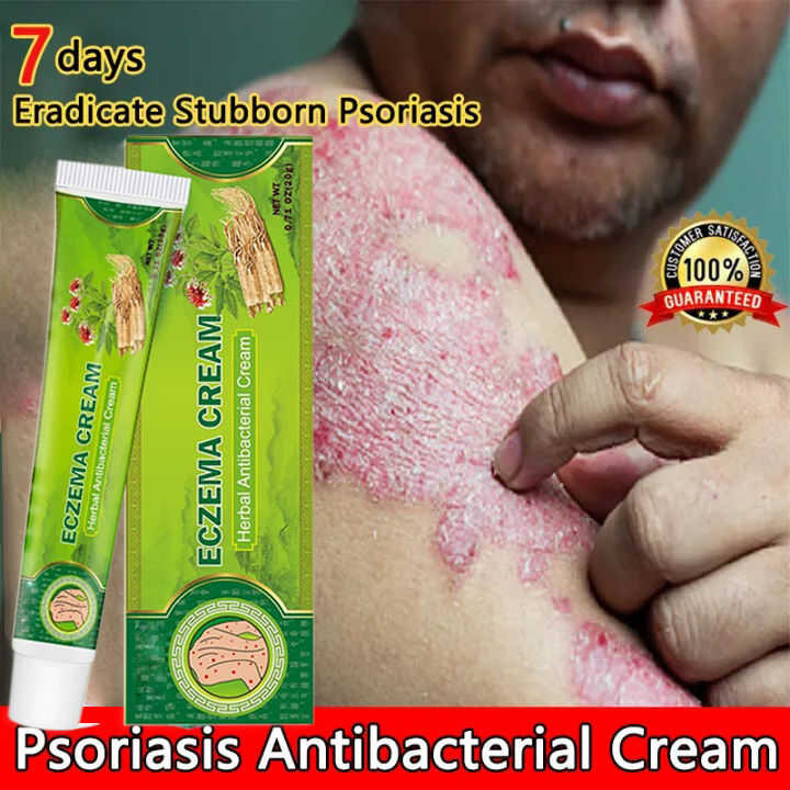Skin Problems Treatment Eczema Cream Dermovate Ringworm Removal/Eczema ...