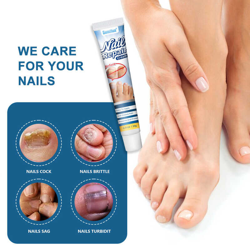 Sumifu Nail Cream Russia WB Coupang Aliexpress | Shopee Philippines