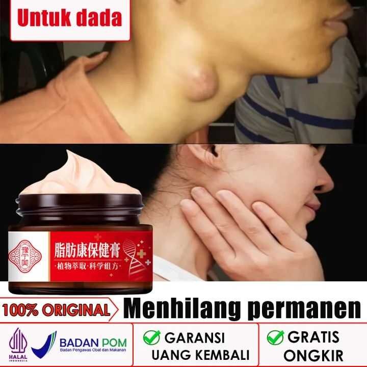 COD Ointment Lumps Medicine for Lumps 100% Original Herbal Effective ...