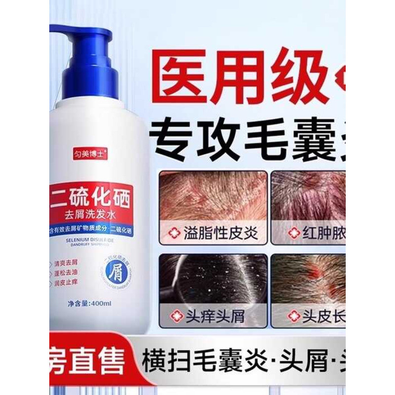 Disulfide Selenium Shampoo For Folliculitis, Scalp Special Anti-Acne ...