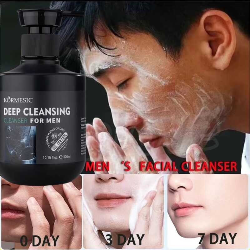 MEN Facial Wash Acne Oil Clear Cream, Cleanser Oily Skin, Skin Care For ...