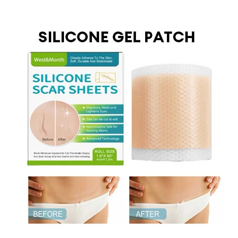 1Roll/Box Reusable Silicone Gel Strip Patch Scar Removal Skin Repair ...