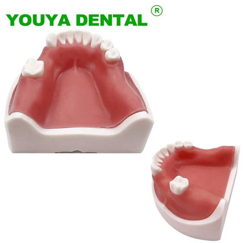 W Dental Teeth Jaw Implant Practice Demo Typodont Soft Gum Study Ching ...