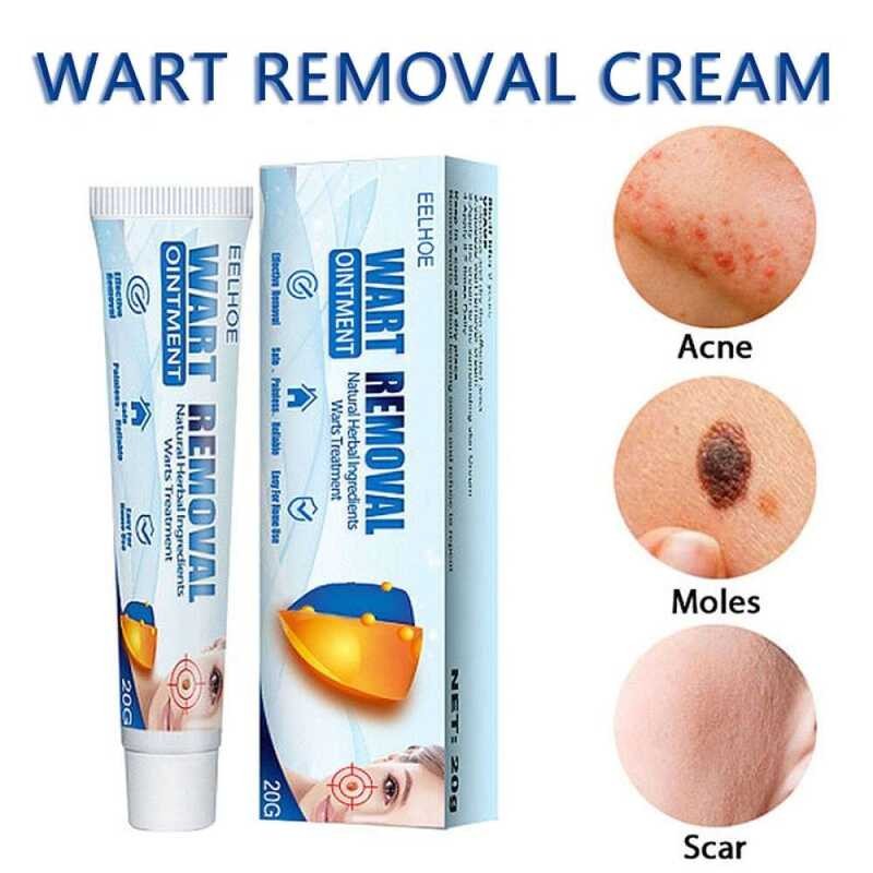 Ointment Painless Wart Treatment Mark Effectively Remover Skin Tags ...