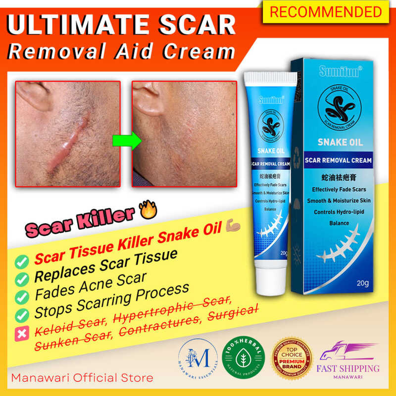 SNAKE OIL Removal Gel By Doc Willie Ong For Old Scars Japanese Scar ...