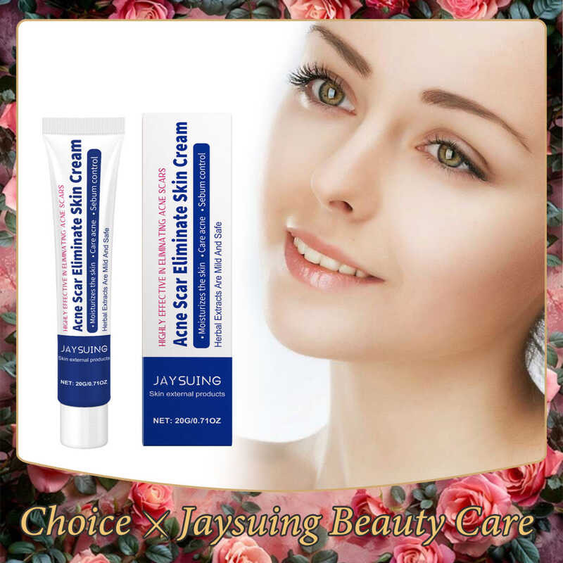 And Acne Freckle Removal Herbal Acne Treatment Facial Repair Cream ...