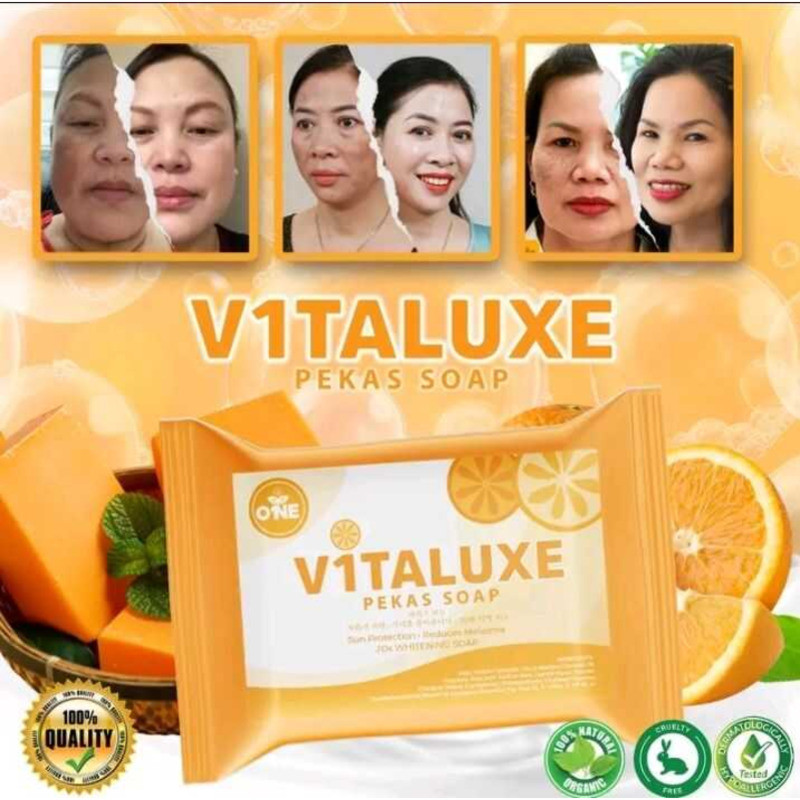 Vitaluxe Pekas Soap Korea (100G) Dark Spots, Melasma, Pekas ...