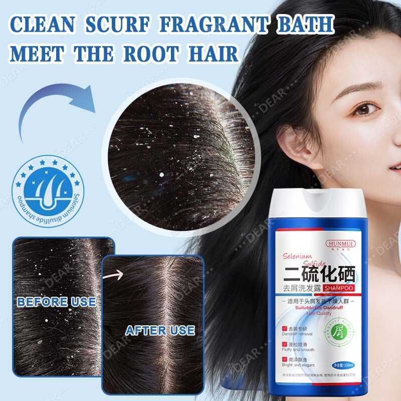 Original Selenium Disulfide Anti Dandruff Shampoo For And Scalp ...