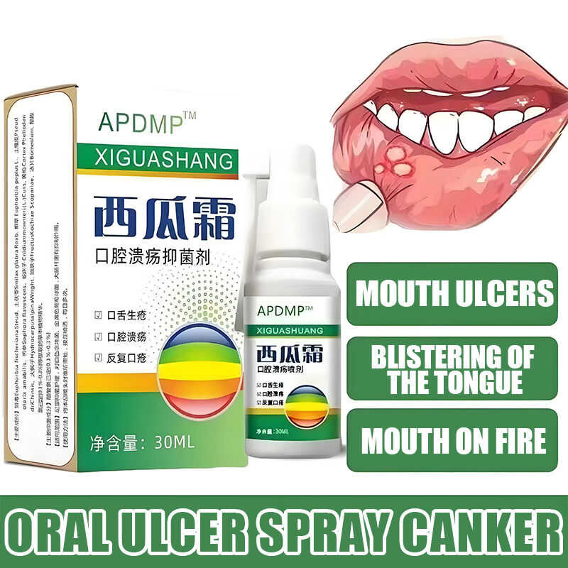 Oral Ulcer Spray Canker Sore Relief Spray Fast-Acting Treatment For ...