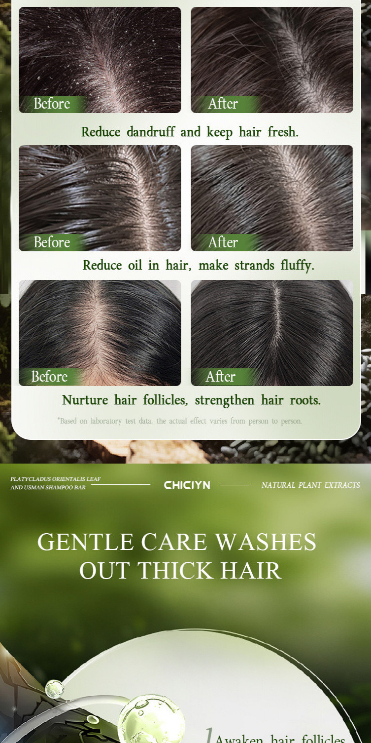 Hair Growth Soap Cypress Leaf Nature Seven Green Herbal Soap For Hair ...