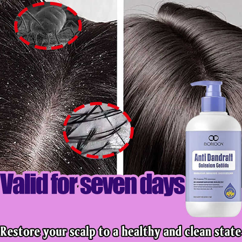 LYDIMOON Selenium Disulfide Shampoo 300Ml, Cleans Your Scalp ...