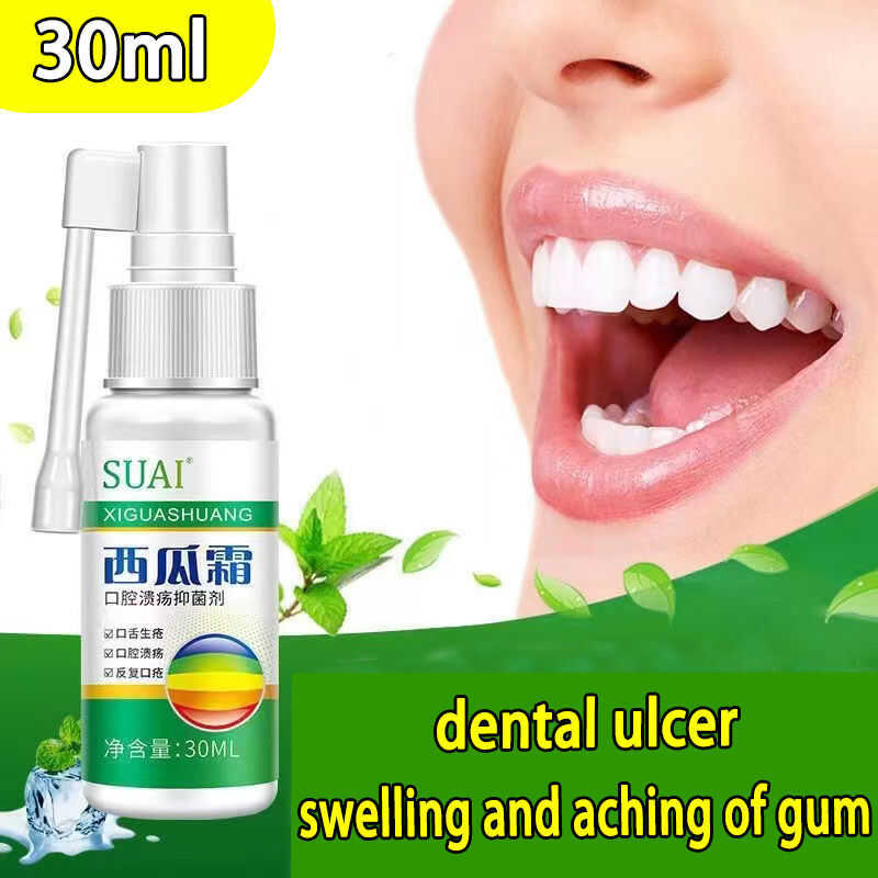 Oral Ulcer Spray To Remove Bad Breath Spray, Oral Detumescence And ...