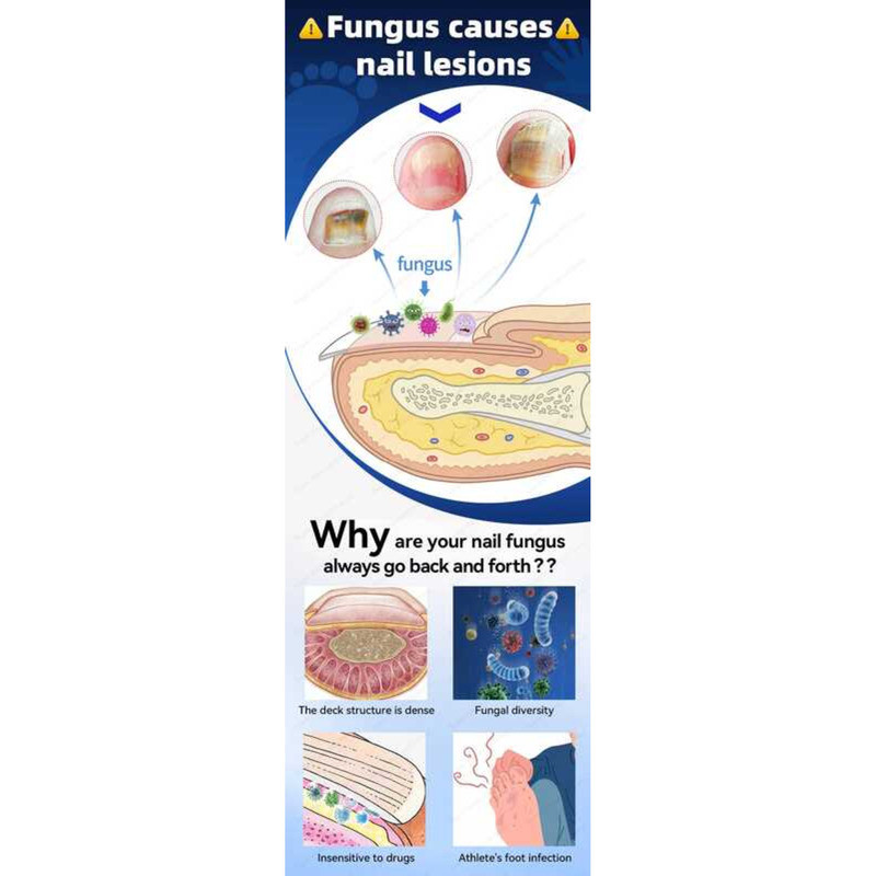 Upgrade,UniAb,Rejuvenator New Fungus Prevention Technology - Adjustable ...