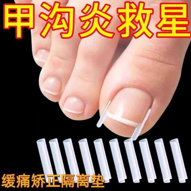 Corrector Filler Pad Ingrown Toenail Anti-Toenail Growing Into Flesh ...