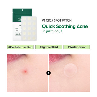 [VT COSMETICS] Spot Patch (12pcs / 48pcs) / Acne Pimple Patch ...