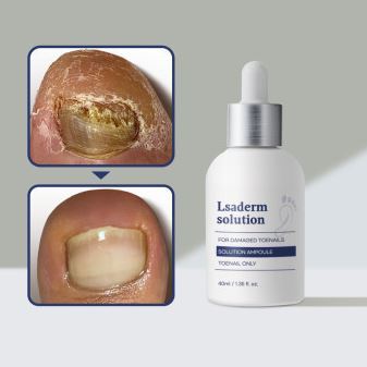 Lsaderm Tea Tree Oil Solution For Foot Fungus Problematic Toenails And ...