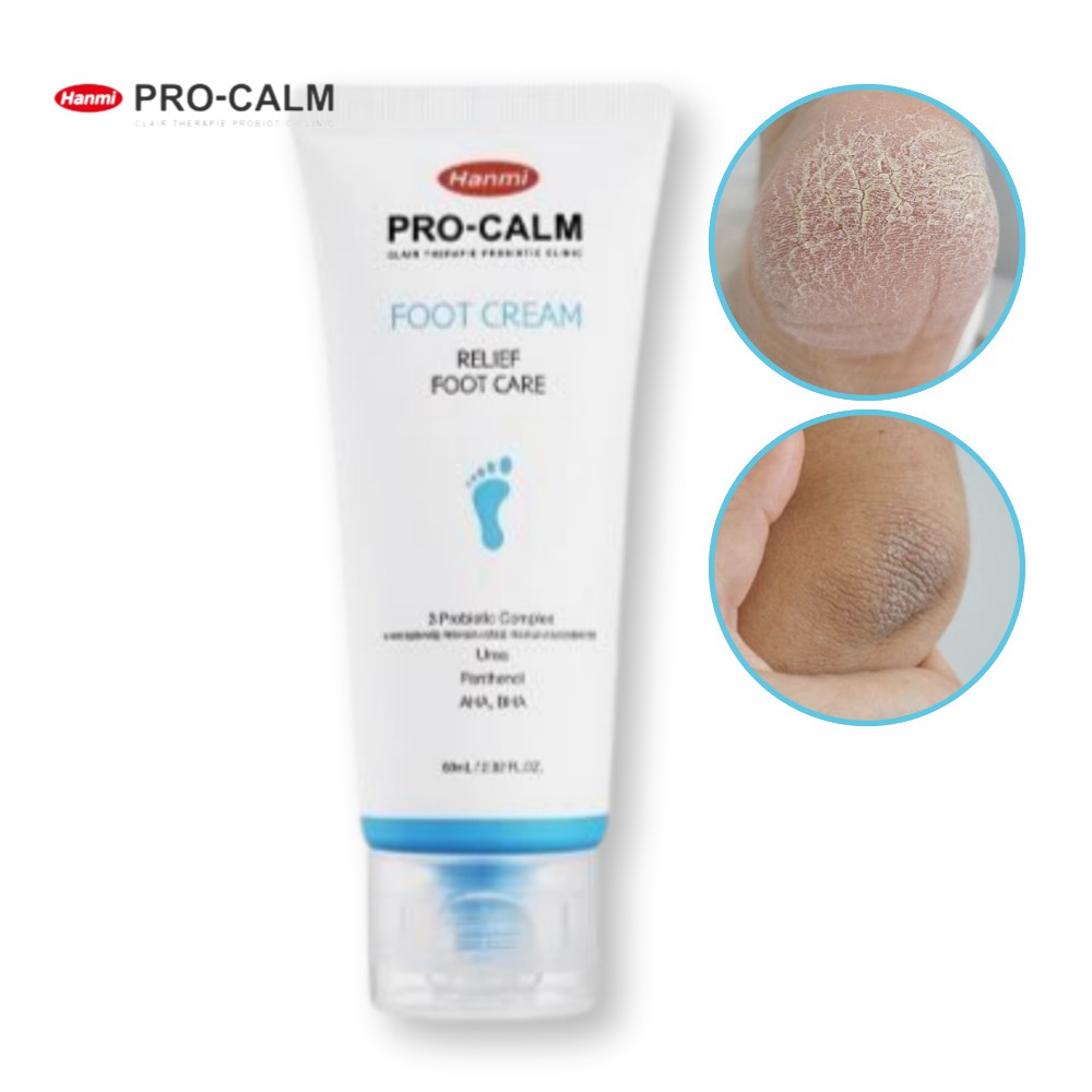 HANMI Procalm Foot Cream 60ml 1EA 2EA Foot care relief Urea 9.5% Zero ...