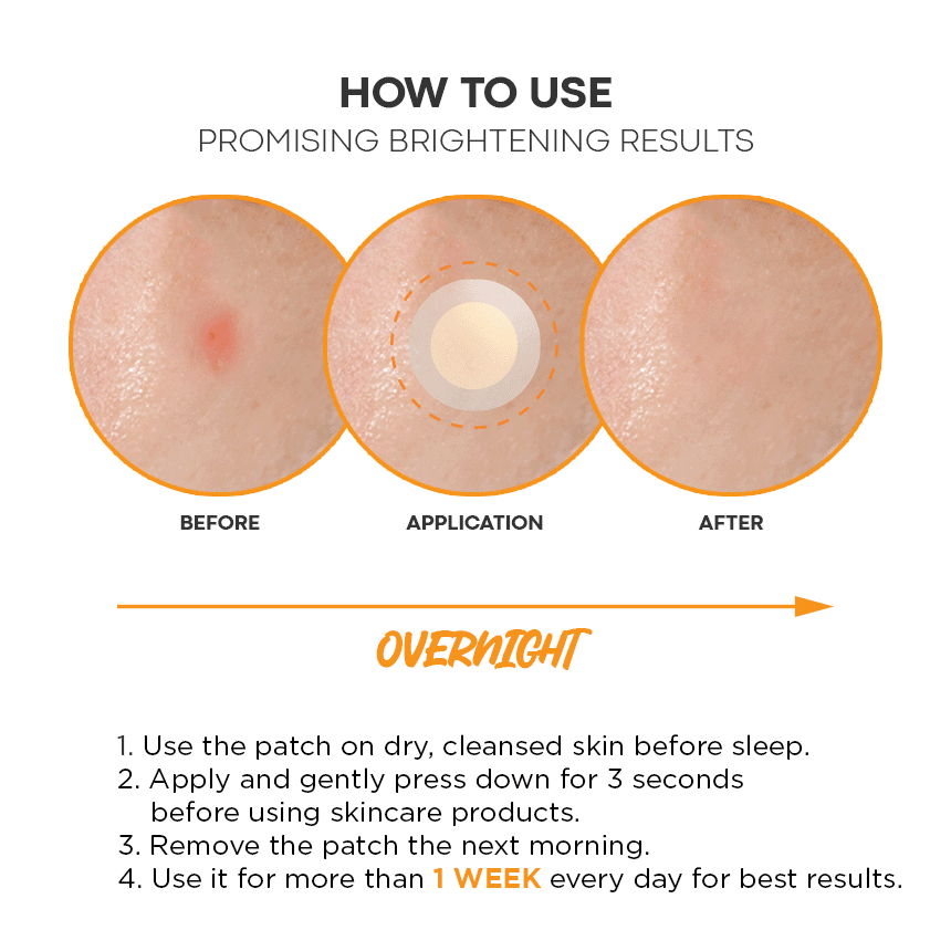 NOLAHOUR Brightening Microneedle Patch 12 Patches Red Spot Care from ...