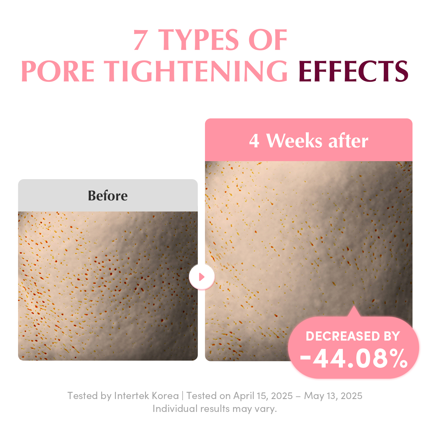[EQQUALBERRY Official] Collagen Pore-Tight Up Gel Toner Pads: Lotus ...