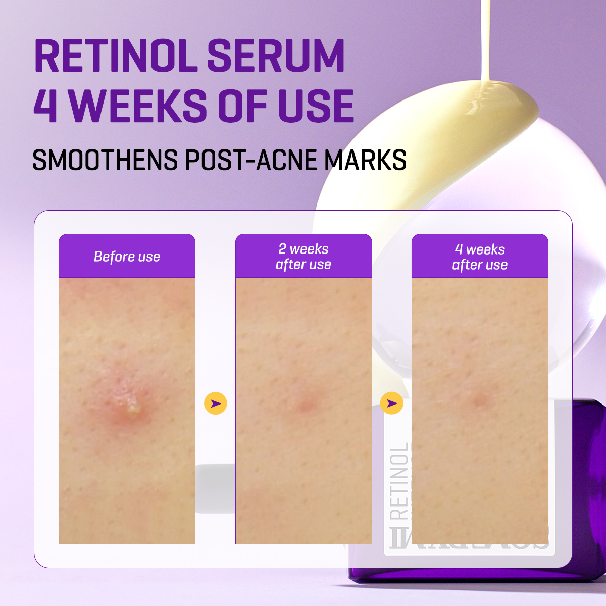 [Mini Set] SOME BY MI OFFICIAL Retinol Intense Trial Kit (Eye cream ...