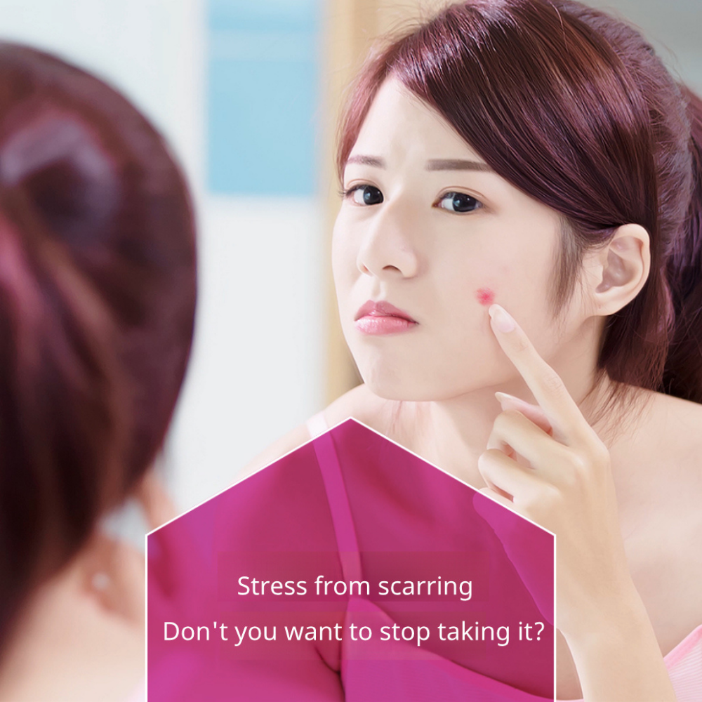 Scarderm Gel 20g - Acne Scar Treatment for Clear Skin, Dermatologist ...