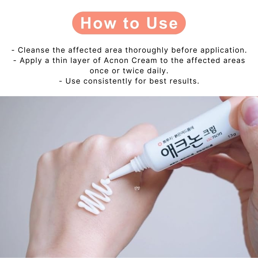 Acnon Cream and Aclean Gel Acne Treatment for Red Acne, Pimples ...