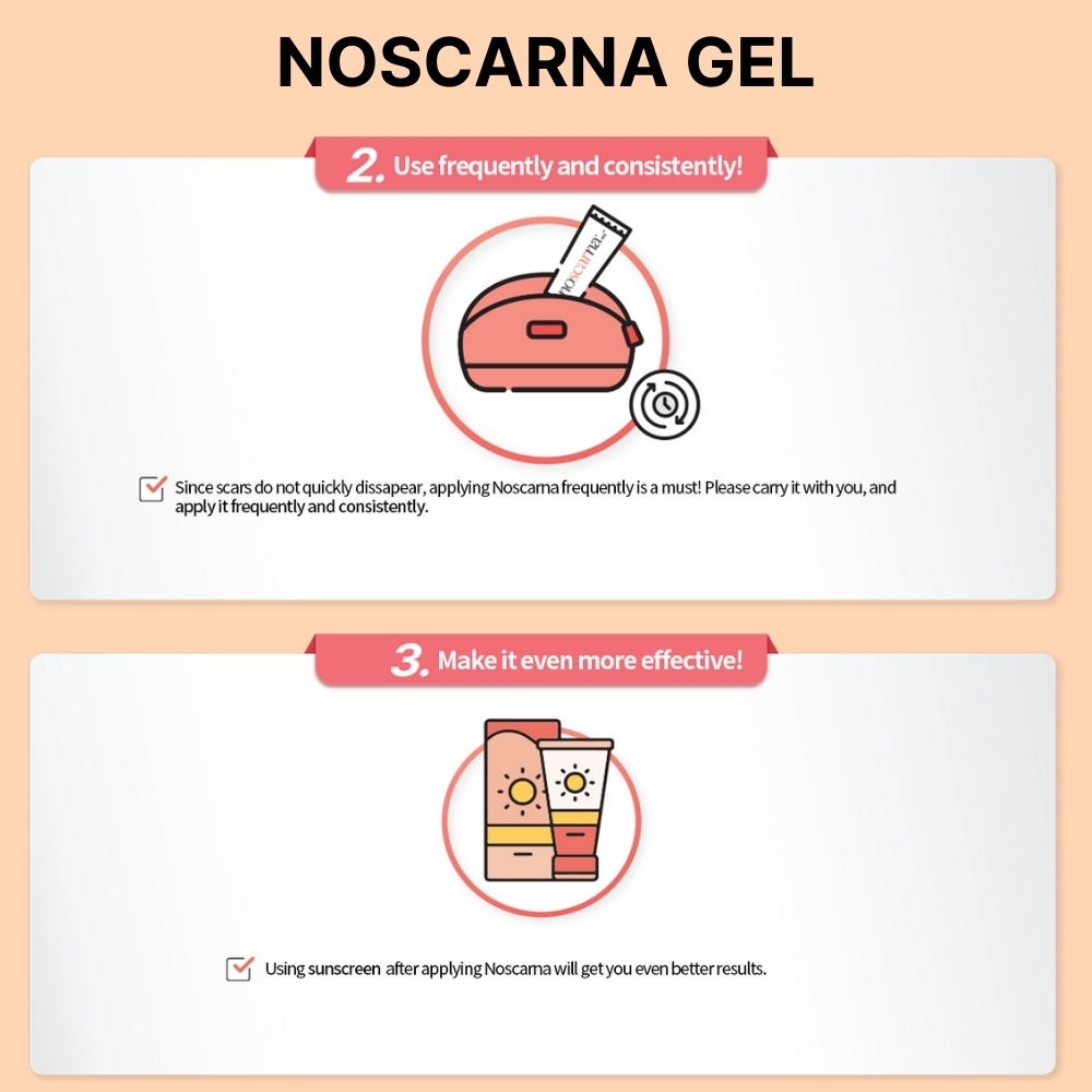 NOSCARNA Gel 10g/20g for Acne Blemish Scars Removal, Clear Marks ...