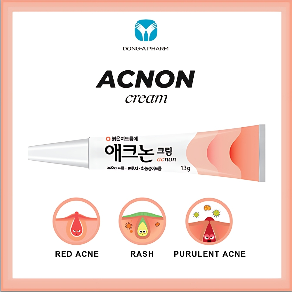 Acnon Cream and Aclean Gel Acne Treatment for Red Acne, Pimples ...