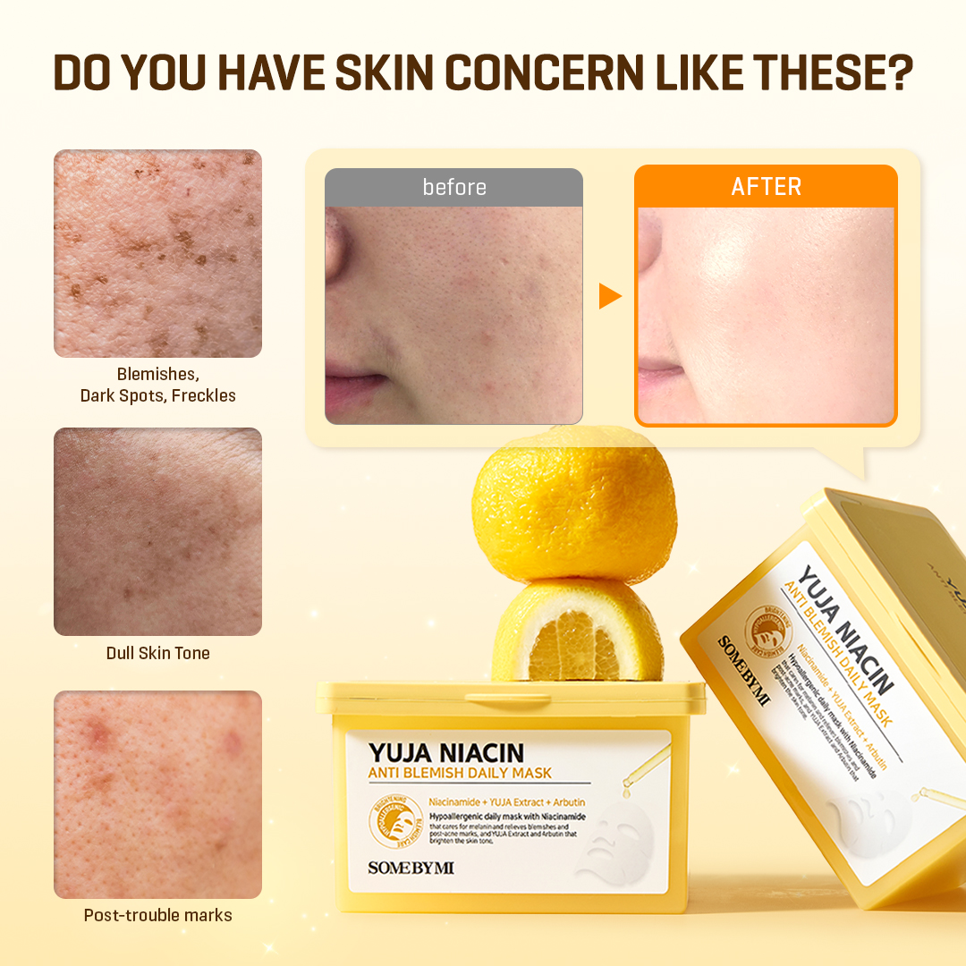 [NEW LAUNCH] SOME BY MI Yuja Niacin Anti-Blemish Daily Mask 30EA ...