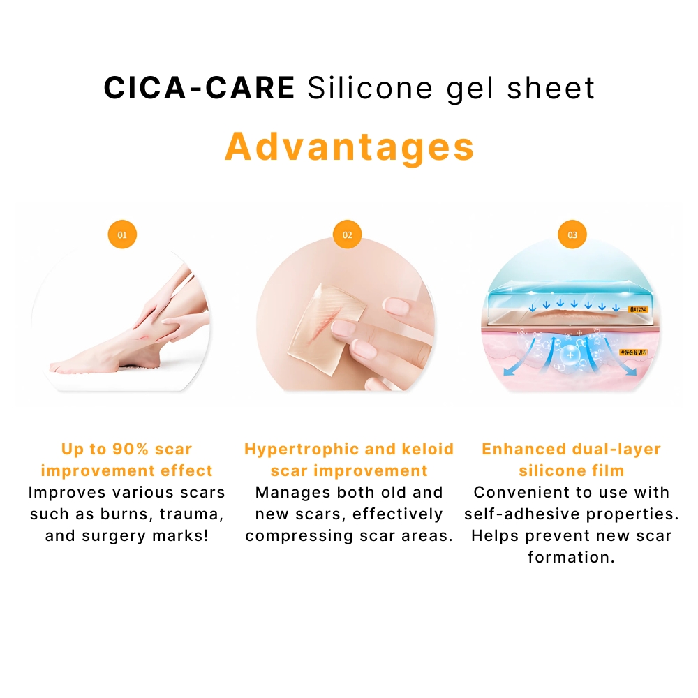 Smith & Nephew Cica Care Scar Silicone Gel Sheet | Effective Scar ...