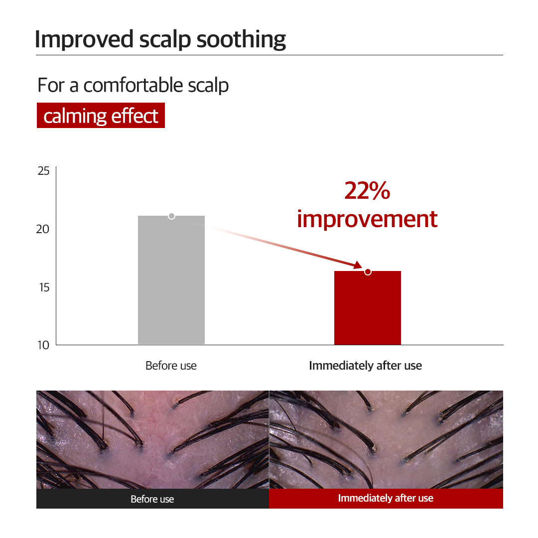 Lemetique Scalp&Hair Nourishing SET(Hair Tonic+Hair Treatment) | Shopee ...