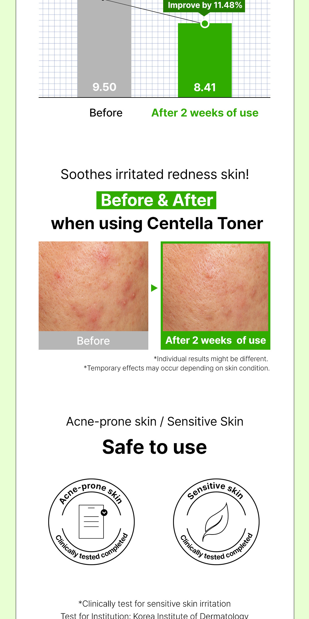 papa recipe Real Centella Cica Soothing Toner (150ml) | Shopee Philippines