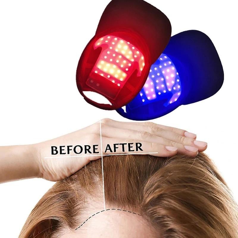 Infrared Hair Growth Instrument Physiotherapy Hair Growth Cap Laser ...