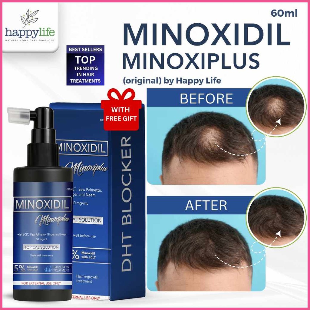 Minoxidil[zU5%^y&MINOXIPLUS!Xi[LCLT,Kz[Hair,eR[Grower,,ZySerum,-VUMen ...
