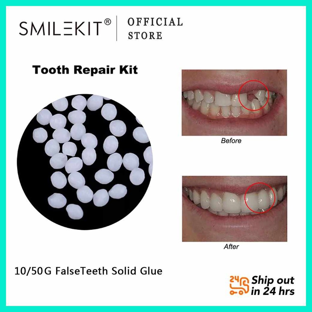10/50g|Ud>Temporary+q]Tooth>fv)Repair}Lc)Kit}QG)Teeth}yc)And}lN)Gaps}Tf ...