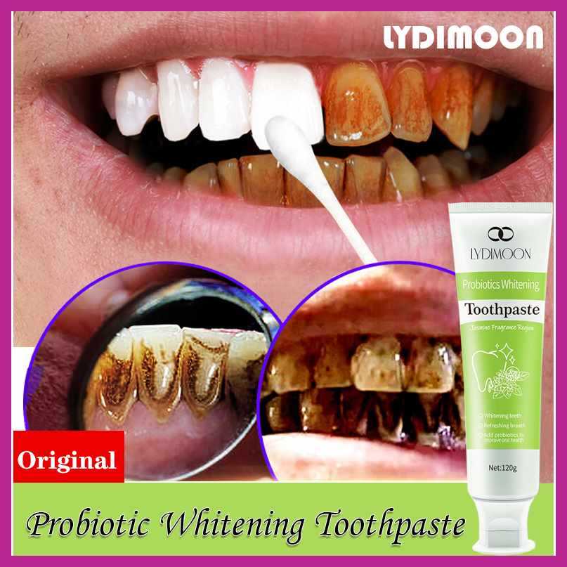 Teeth Whitening Toothpaste Set Tartar Removal For Teeth Bad Breath ...